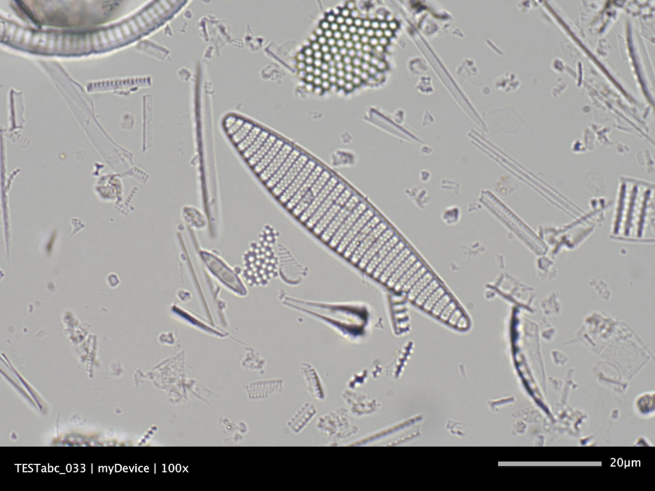 Using a microscope camera in marine research | Jenoptik